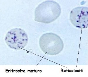 Reticolociti : (Molfetta)