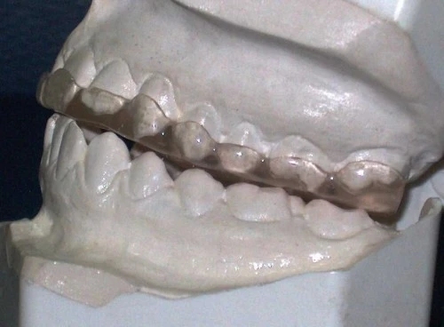 - Placca di Michigan : (Palermo)